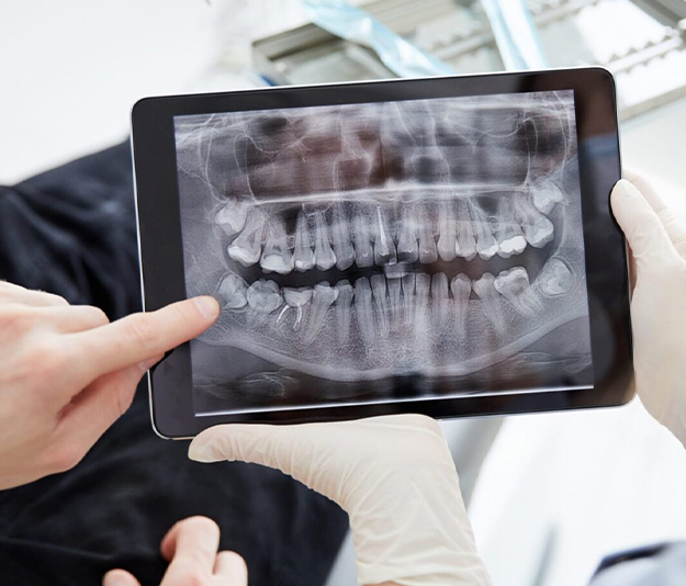 Digital X Rays Spring Hill FL | Northcliffe Dental